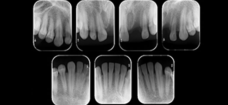 Servicios | Endo Dental Care